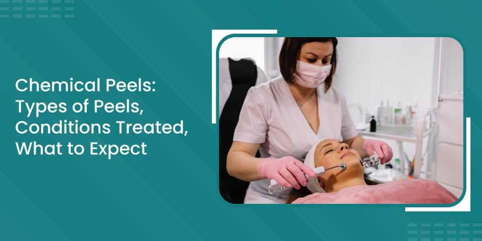 What Is Chemical Peel Treatment, Its Procedure, And More - Skinerva Clinic